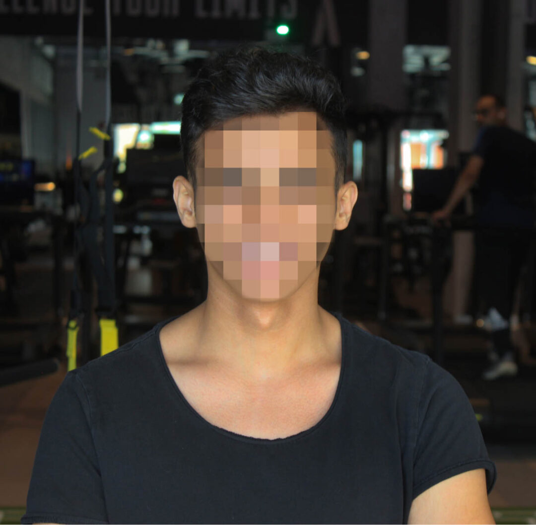 How To Blur & Pixelate Faces In Photoshop (Step By Step)